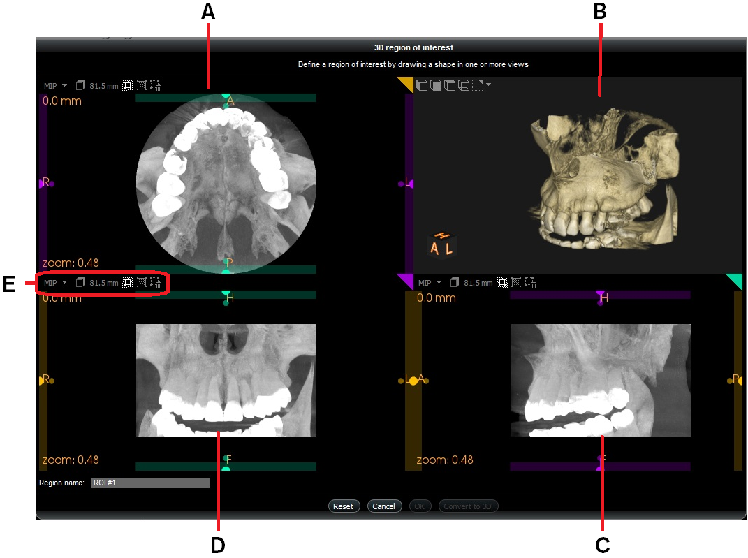 Using the Custom Region of Interest Tool (2D)