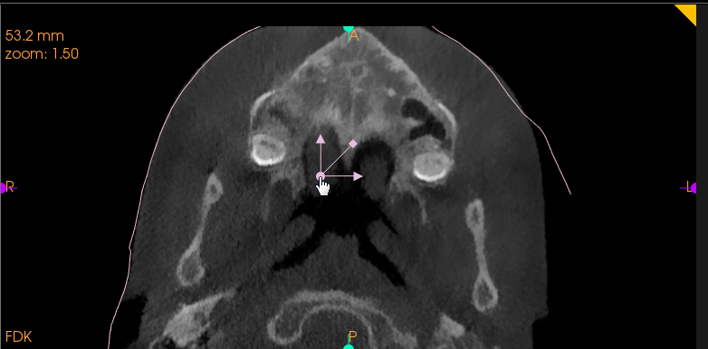 Manually Adjusting a Face Scan Alignment