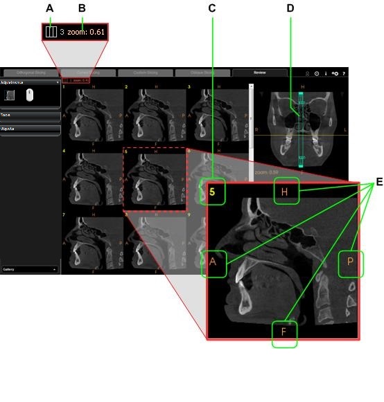Using the Slice Series View Screen in the Review Tab